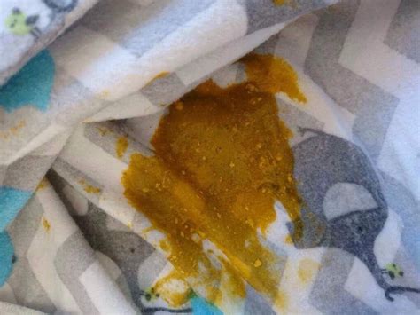 Випорожнення немовлят ГО Молочні ріки України