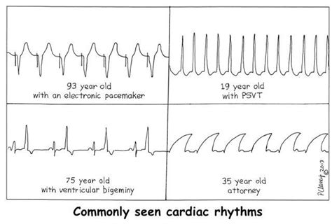 The 25 Best Cardiac Rhythms Ideas On Pinterest Heart Rhythms Cardiac Arrhythmia And Nursing