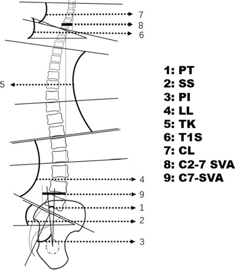 Method To Measure Spino Pelvic Sagittal Alignment Pt Pelvic Tilt Ss Download Scientific