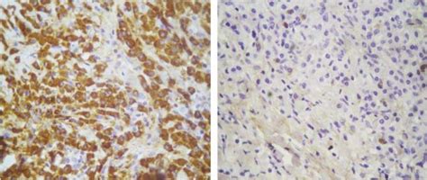 Immunohistochemical Analysis For Kappa And Lambda Light Chain Download Scientific Diagram