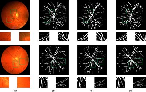 Figure 8 From Td Swin Unet Texture Driven Swin Unet With Enhanced Boundary Wise Perception For