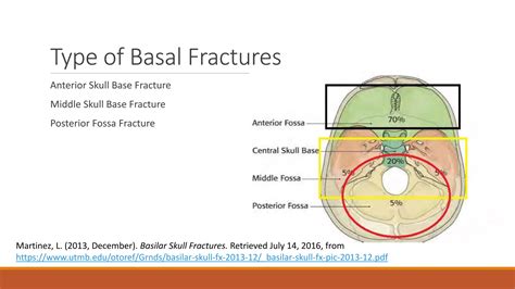 Basal Skull Fractures Pptx