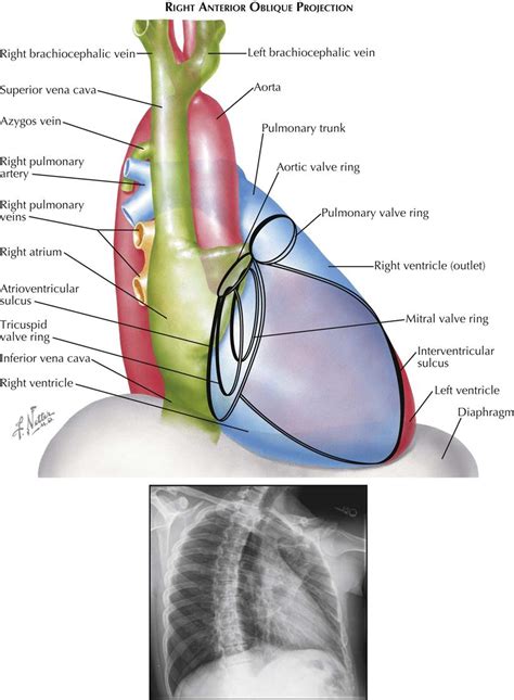 3 Imaging Thoracic Key