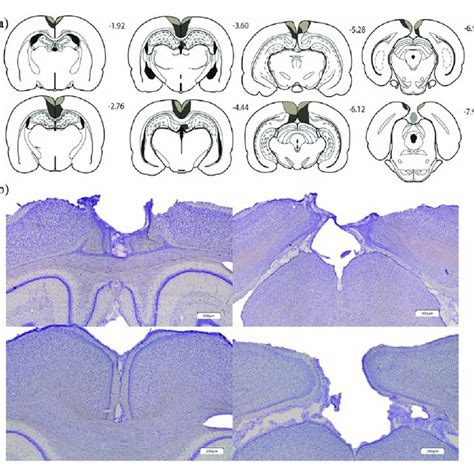 Pdf Lesions Of Retrosplenial Cortex Spare Immediate Early Gene