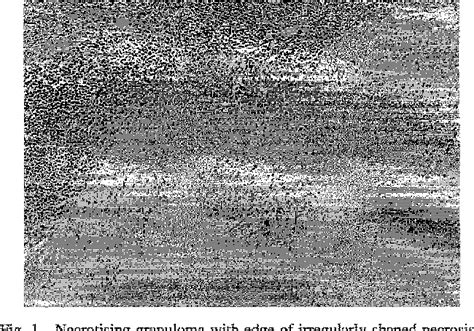 Suppurative Lymphadenitis Semantic Scholar