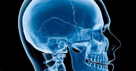 Craniosynostosis Types Causes Diagnosis And Treatment