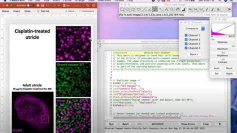 Cell Counter Imagej Fiji Ommens
