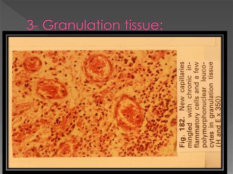 Ppt Healing And Gangrene Powerpoint Presentation Free Download Id