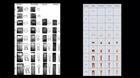 Age Estimation In Forensics Pptx