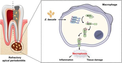 Enterococcus Faecalis Infection Biol 230 Lecture Guide Enterococcus