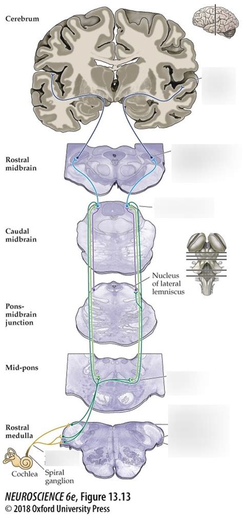 Central Auditory Pathway Diagram Quizlet