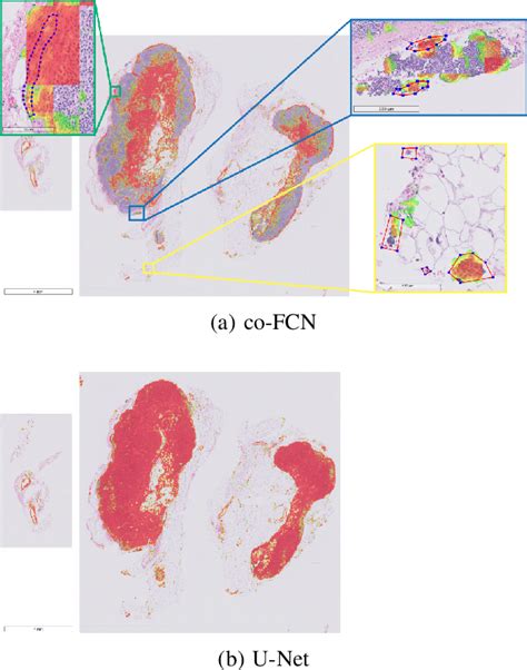 Figure 5 From Conditional Deep Convolutional Neural Networks For Improving The Automated