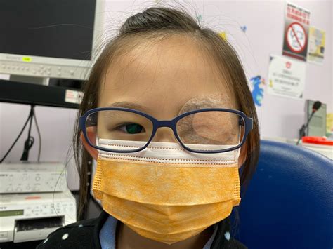 信报：何谓懒惰眼？探讨弱视的成因与治疗 中大眼科 Cuhk Dovs
