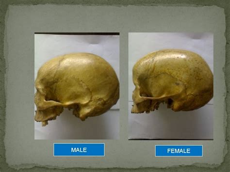 Sex Determination From Human Skeletal Remains Skull Pelvis