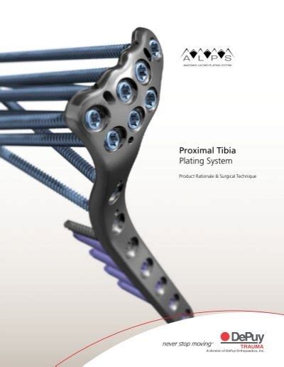 Proximal Tibia System Product Rationale Surgical Biomet