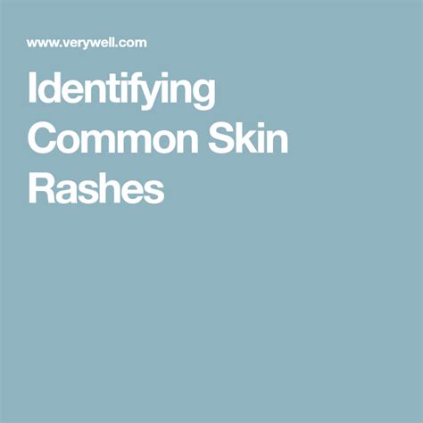 How To Identify 10 Common Skin Rashes Artofit