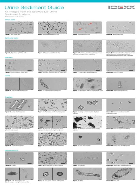 Sedivue Urine Sediment Guide Medical Specialties Biology