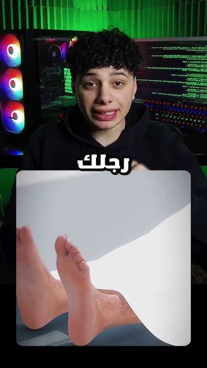 كيف تعمل جراحة إصبع القدم إلى الإبهام 😱shorts Youtube