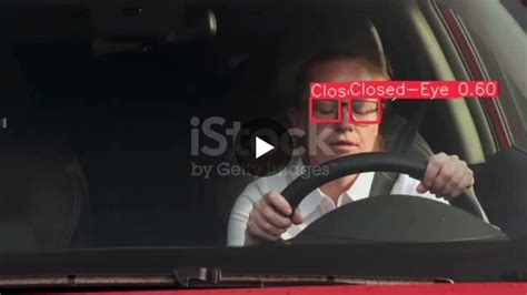 Driver Drowsiness Detection With Ai And Computer Vision Yolovx Posted On The Topic Linkedin