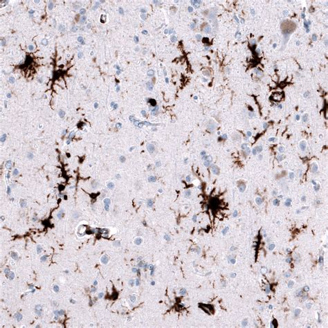 Mouse Monoclonal Anti Hla Dra Antibody Buy For Research Highly
