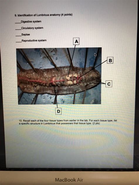 Solved 9 Identification Of Lumbricus Anatomy 4 Points