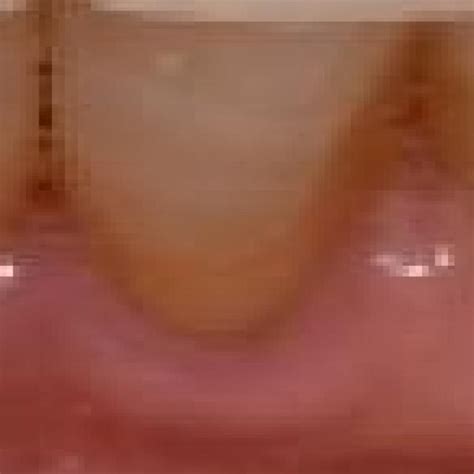 Teeth Detection Object Detection Model By Pilotcode