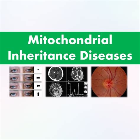 Examples Of Mitochondrial Inheritance Diseases Rish Academy Examples Of Mitochondrial Inheritance Diseases Rish Academy