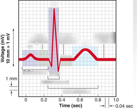 Ecg Complex Diagram Quizlet