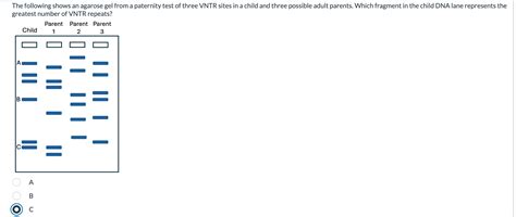 The Following Shows An Agarose Gel From A Paternity