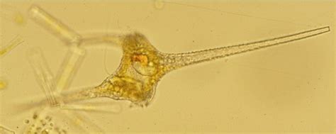 Algae Deck Chrysophyta Cryptophyta Euglenophyta Xanthophyta And