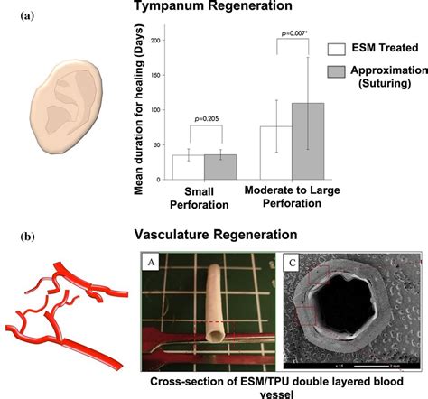 A Healing Time Recorded In Patients With Different Grades Of Tympanic Download Scientific