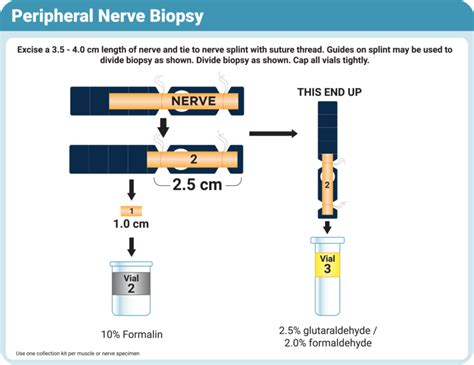 Nerve Biopsy Therapath Neuropathology