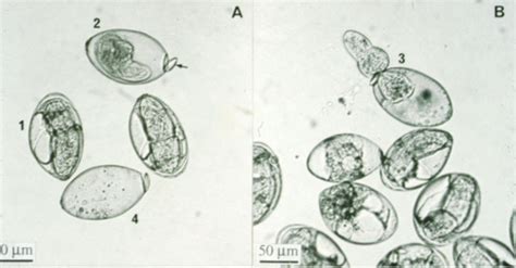 Lab 4 Trematode Anatomy And Life Cycles Flashcards Quizlet