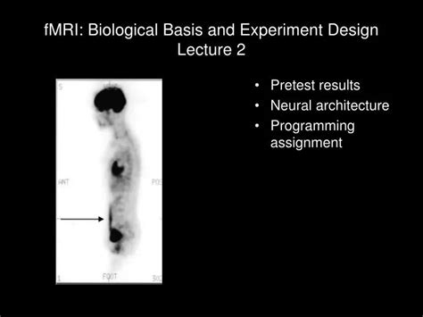 PPT FMRI Biological Basis And Experiment Design Lecture PowerPoint Presentation ID