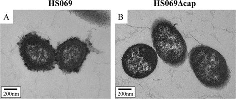 Transmission Electron Microscopy Visualization Of Capsule The Capsule