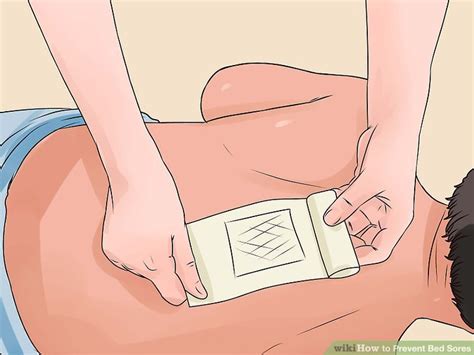 3 Ways To Prevent Bed Sores Wikihow