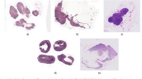 Multi Domain Stain Normalization For Digital Pathology A Cycle Consistent Adversarial Network