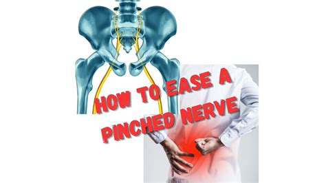 How To Ease A Pinched Nerve Active Life Chiropractic