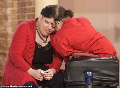 Worlds Oldest Conjoined Twins Lori And George Schappell Dead At 62