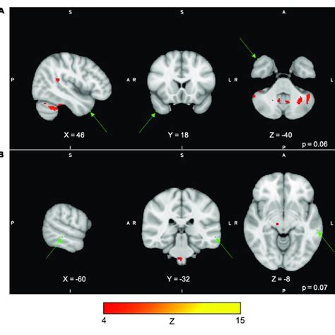 FMRI Data Analysis Pipeline Download Scientific Diagram