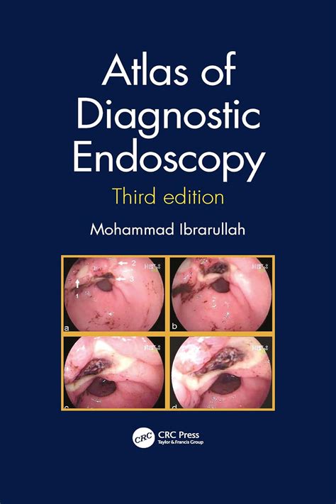 Atlas Of Diagnostic Endoscopy 3e 9781032084381 Medicine And Health