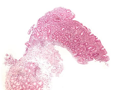 Epithelium3d Duodenum