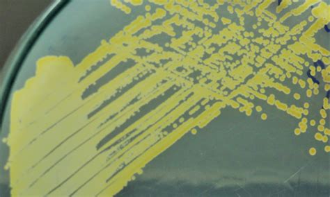 Micrococcus Luteus Pure Microbes