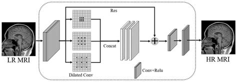Magnetic Resonance Reconstruction Method Of Super Resolution Convolutional Neural Network Based