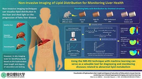 Machine Learning Hones Ability To Image Liver Disease Bioscan Marapr 2024 Photonics Spectra