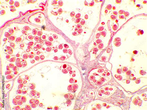 Cisto Hidatico De Echinococcus Granulosus Echinococcus Granulosus Life