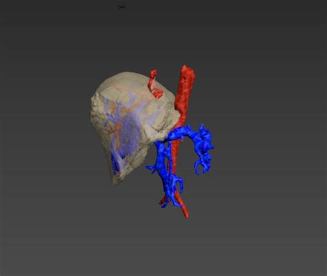 Stl File Liver With Vane Medical Liver・3d Printable Model To Download・cults