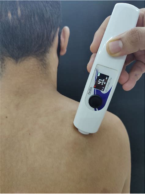 E Vapometer Used To Measure Tewl G M 2 H Download Scientific Diagram