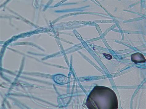 Labopart Microsporum Ferrugineum