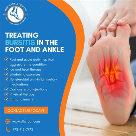 Bursitis Bursitistreatment Footanklebursitis Foothealth Footcare